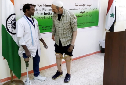 Free Artificial Limbs | Jaipur Foot: Prosthetic Limbs