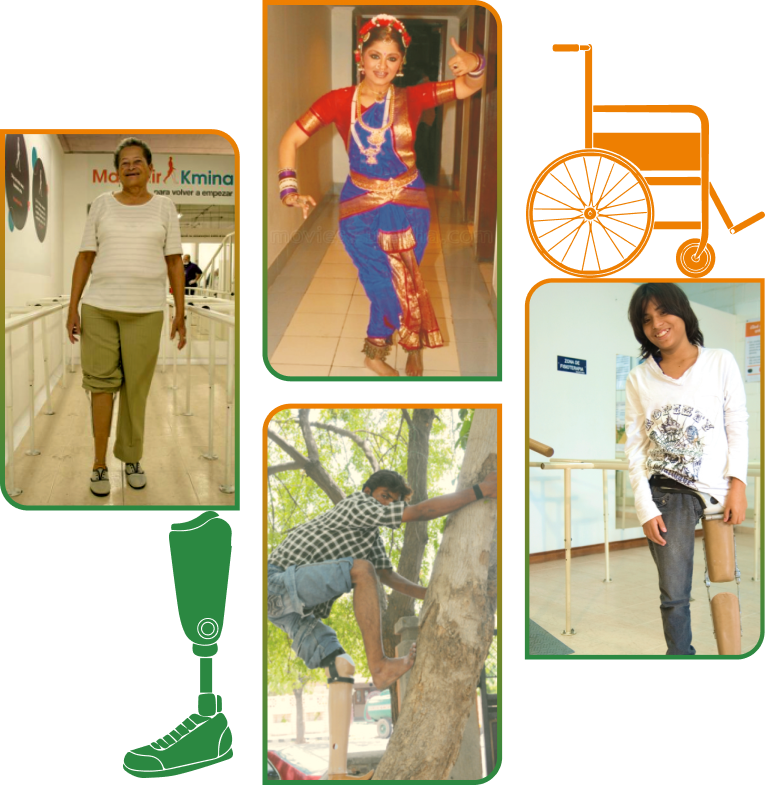 Free Artificial Limbs | Jaipur Foot: Prosthetic Limbs