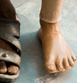 Jaipur foot - Making big strides - Jaipurfoot